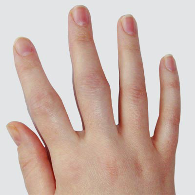 RhePort.de - Rheumafragebogen